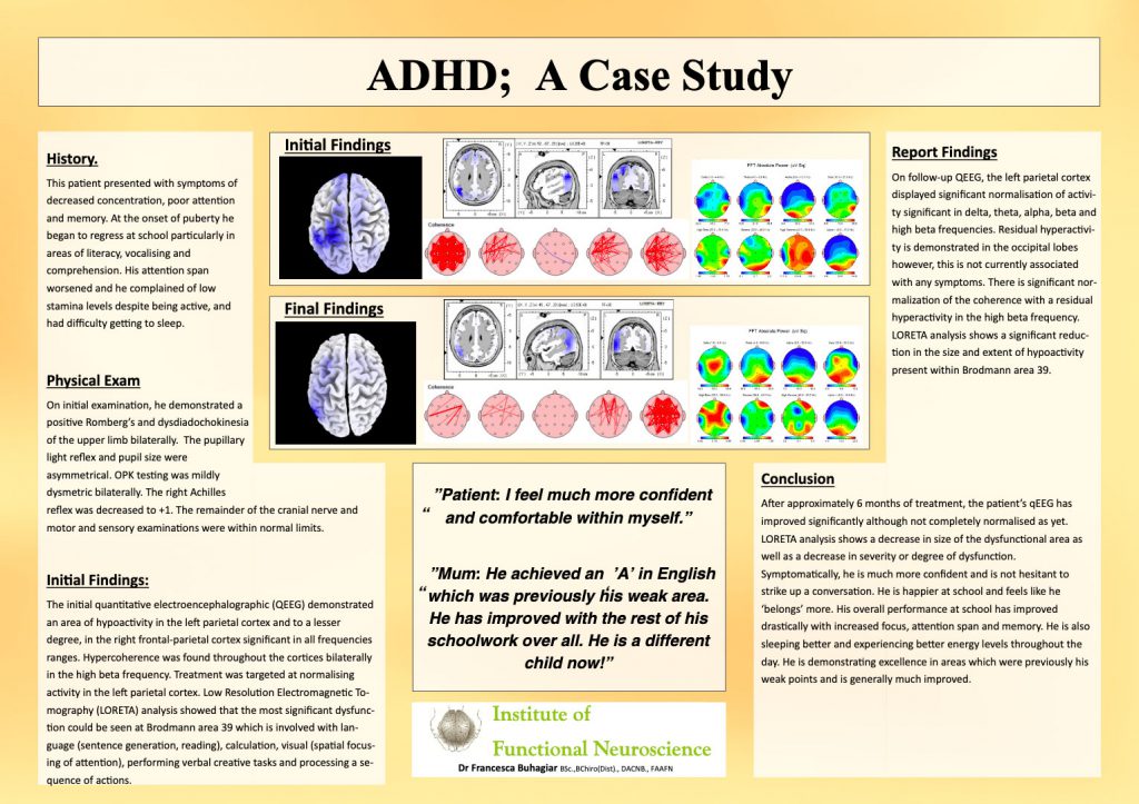 ADHD | The Institute of Functional Neuroscience